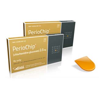 PerioChip 2.5mg (20pcs) : 歯科材料の輸入通販:スマイルUS