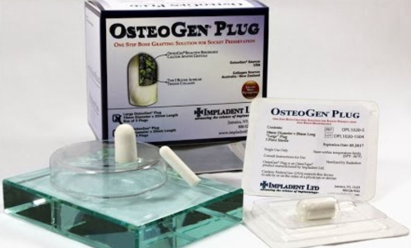 OsteoGen（オステオジェン） : 歯科材料の輸入通販:スマイルUS